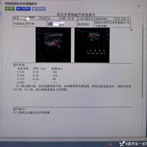 手机出现粉红色线条图标