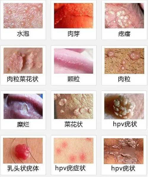 女性里面有个小疙瘩是怎么回事截图