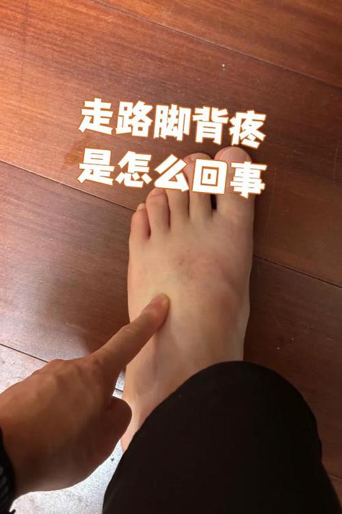 怎么判断自己痛风了
