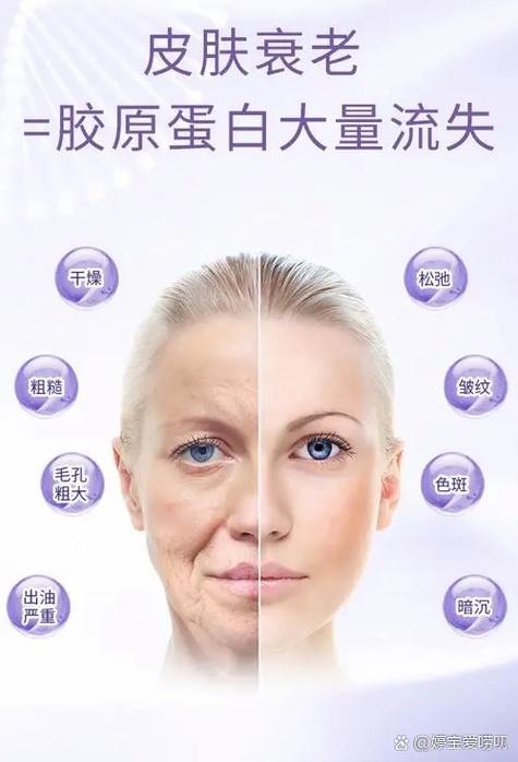 胶原蛋白多少钱一针