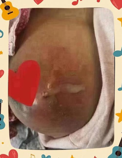 喂奶后乳头刺痛像针扎图标