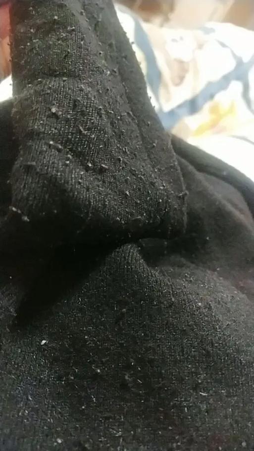 衣服起球了还穿丢人吗图标