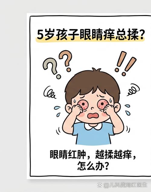 过敏性皮炎眼睛周围多久退红图标