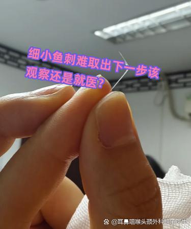 舌头上扎了鱼刺找不到图标