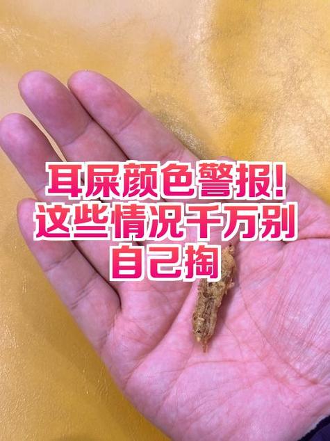 耳朵被耳屎堵住了怎么办截图