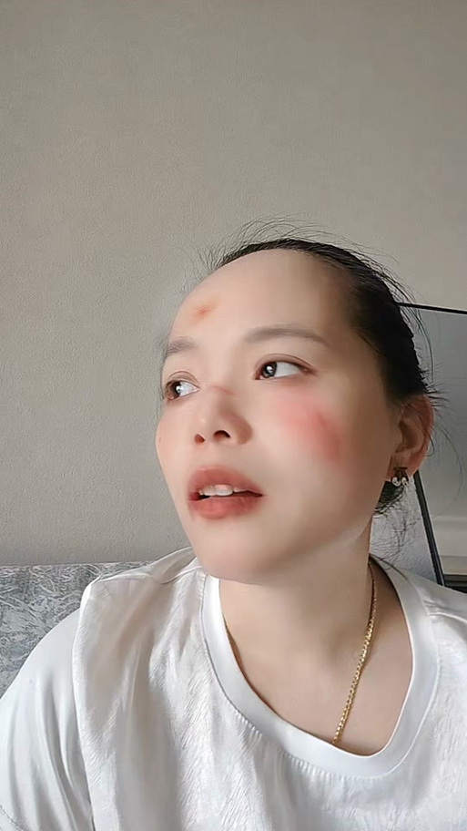 抖音脸受伤的特效图标