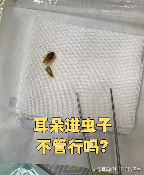 虫子飞进耳朵里能活吗截图