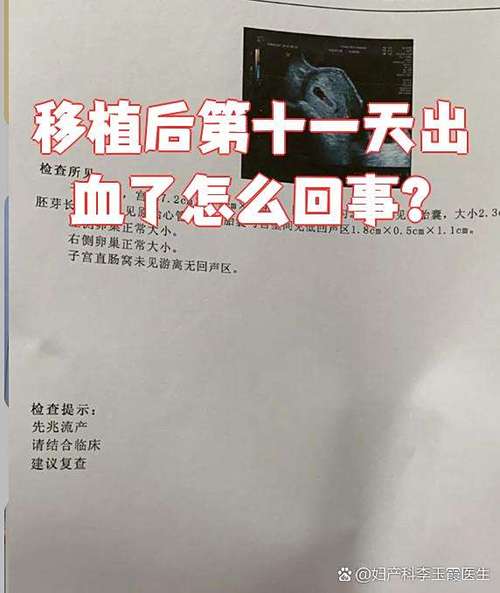 移植后图标