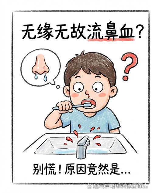 为什么会无缘无故流鼻血截图