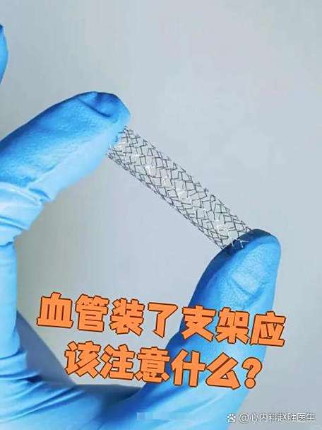 血管一旦放了支架就意味着什么图标