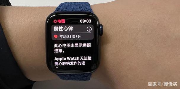 applewatch心电图准吗图标