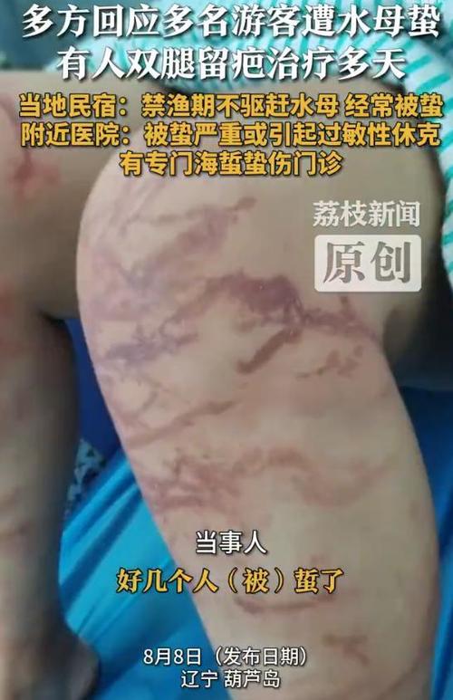 水母咬人吗图标
