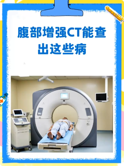 做增强ct能查出肿瘤吗截图