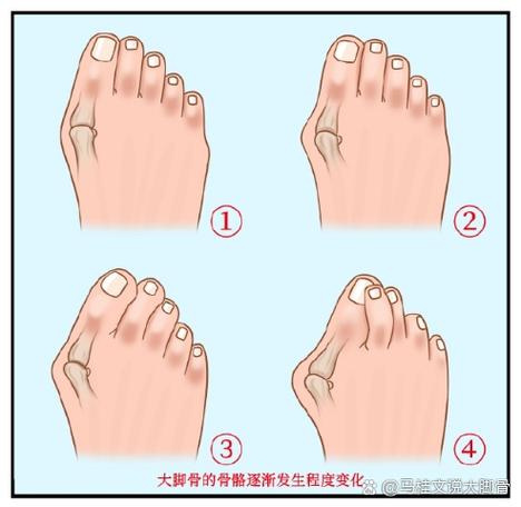 大脚怎么显示治疗量图标