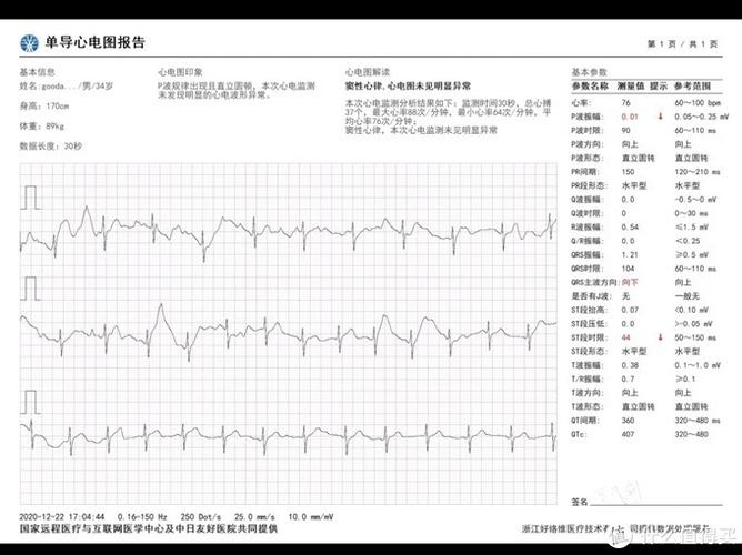 医学上ecg代表什么意思图标