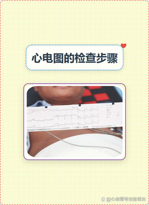 applewatch的ecg准吗图标