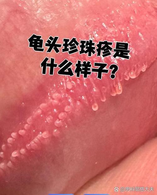 男性外皮长了很多小颗粒