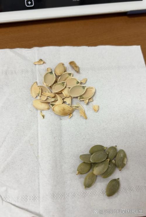 南瓜子是生吃还是熟吃治前列腺炎图标