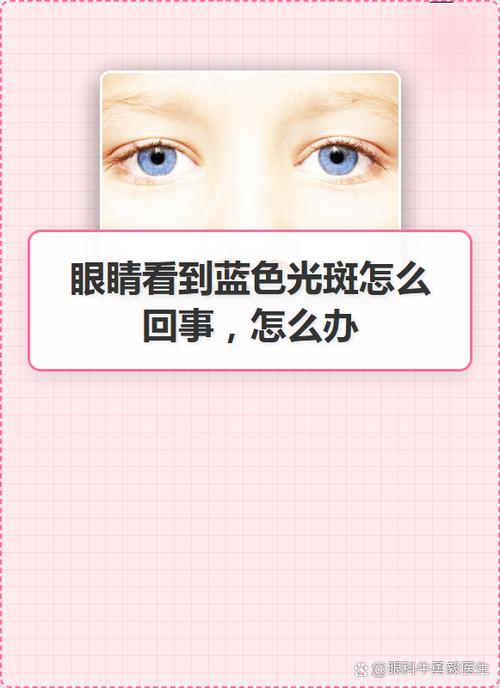 眼前出现一块光斑图标