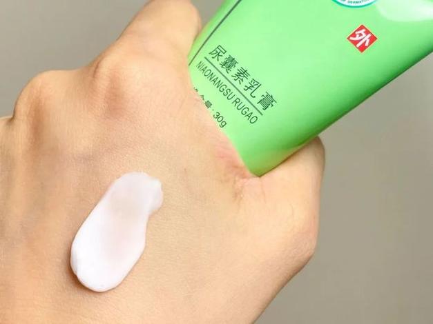 鱼鳞病用什么药膏最好图标