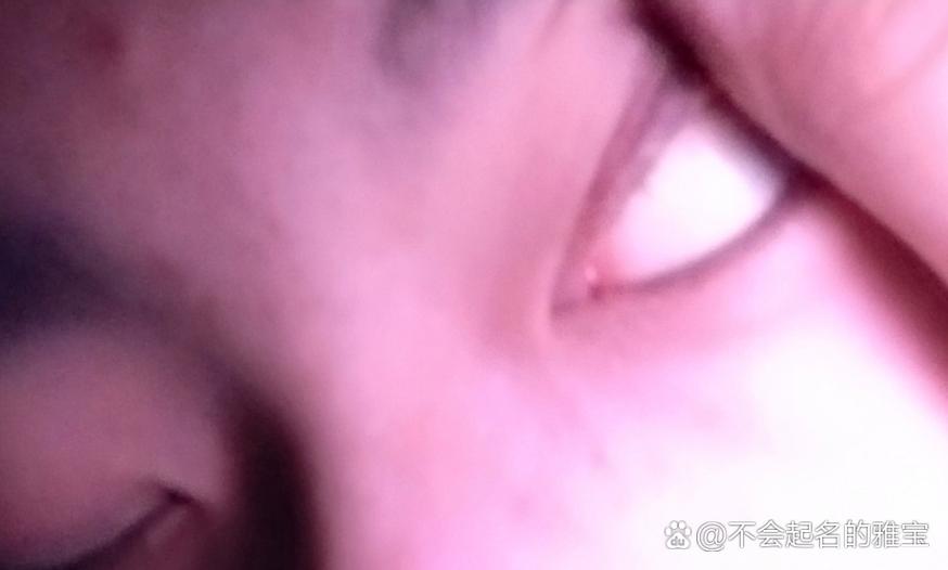 如何翻白眼全白