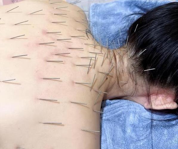 浑身像小针尖扎一样图标