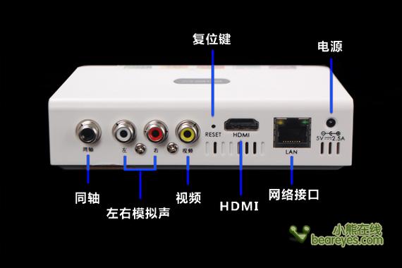 看网络电视需要什么设备