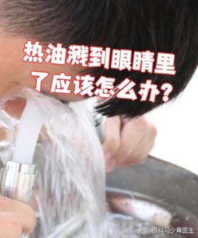 眼睛里溅到热油怎么办图标