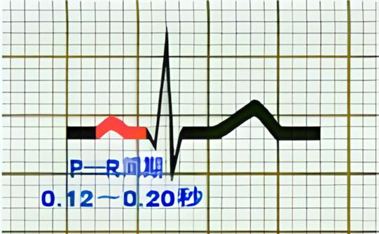 短pr间期能自愈吗图标