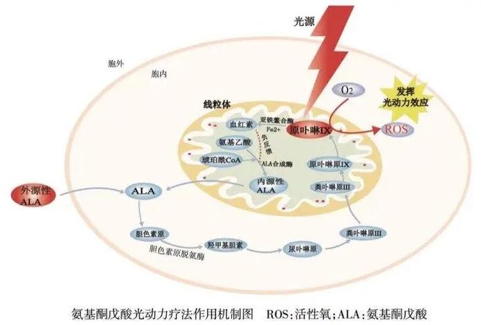 pdt治疗图标