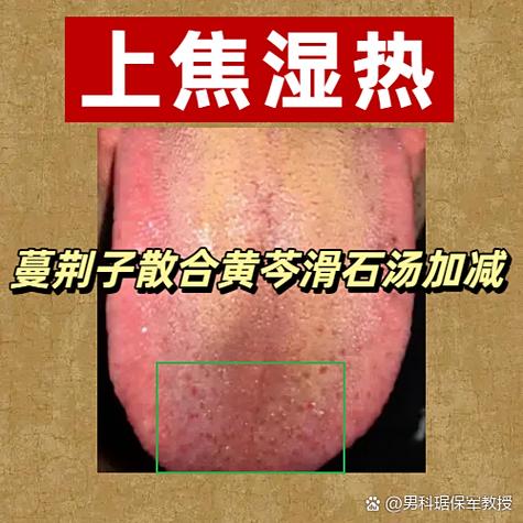 耳朵丝丝响是什么原因截图
