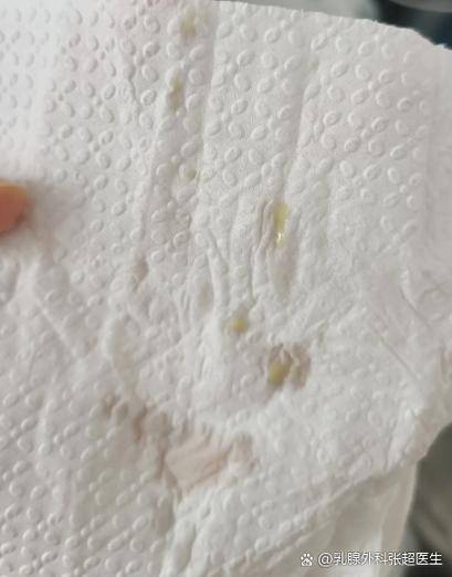 乳房用力挤有像脓一样的液体