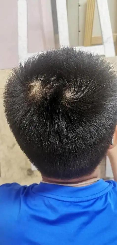 男孩额头有旋图片图标