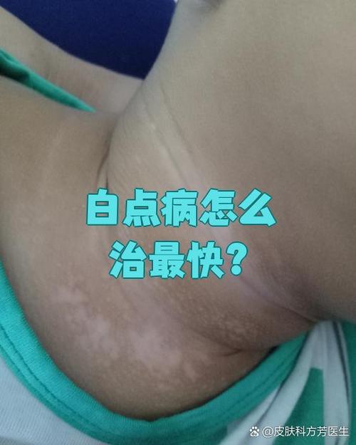 ipad的白点怎么调出来图标