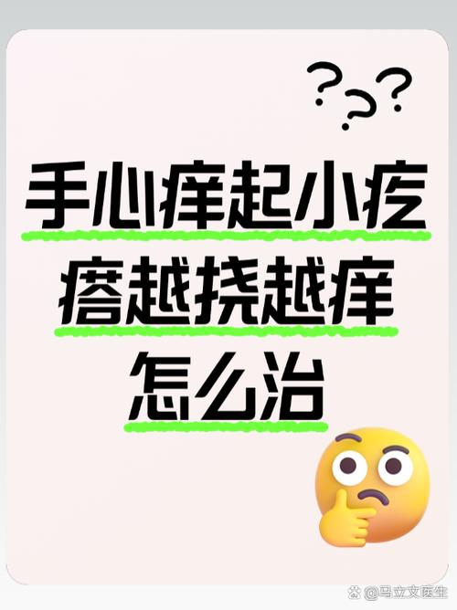 喜欢挠手心是什么原因图标