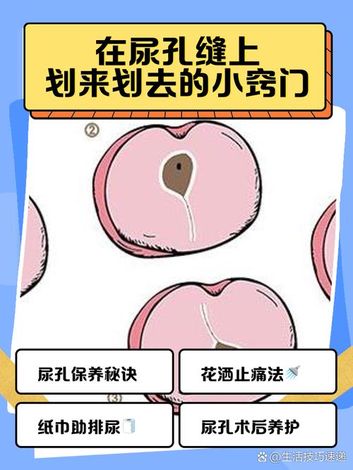 尿sg代表什么图标