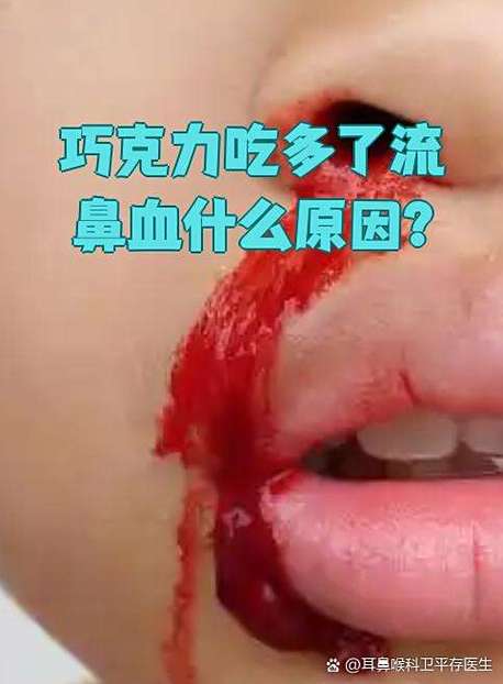 孩子吃完肉巧克力流鼻血原因图标