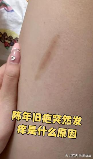 老疤最火的一句图标