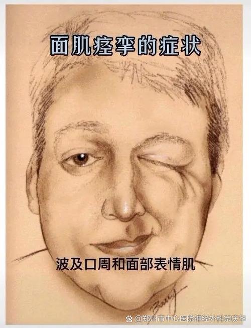 脸部不停的抽搐是怎么回事图标