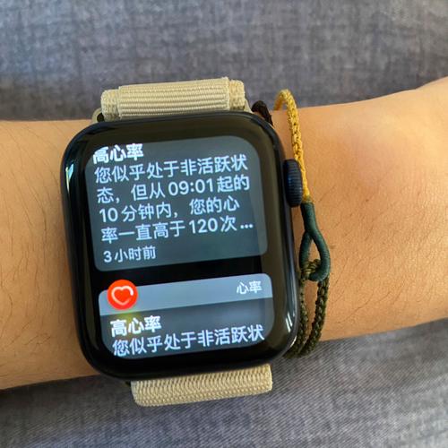 苹果手表测心率到底准不准