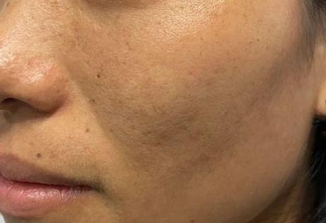 脸黄怎么办