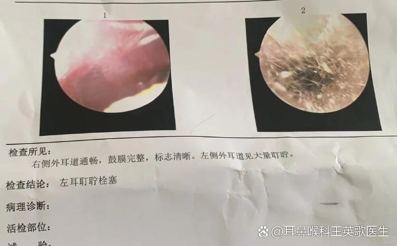 耳朵里轰隆轰隆响是怎么回事图标