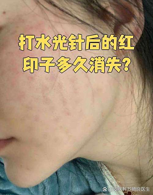 脸色发黑无光泽是怎么回事图标
