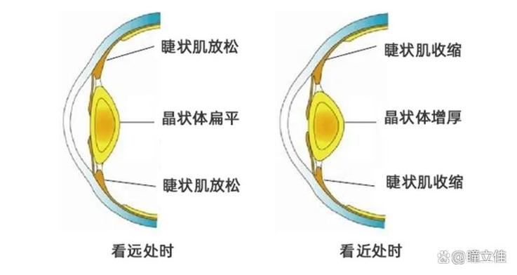 近视眼用凸透镜还是凹透镜图标