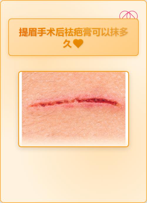 恢复被涂抹的图片图标