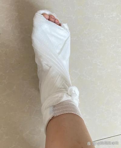 壁虎骨折能恢复吗截图