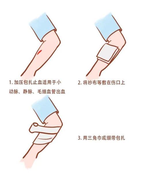 治流鼻血的方法图标