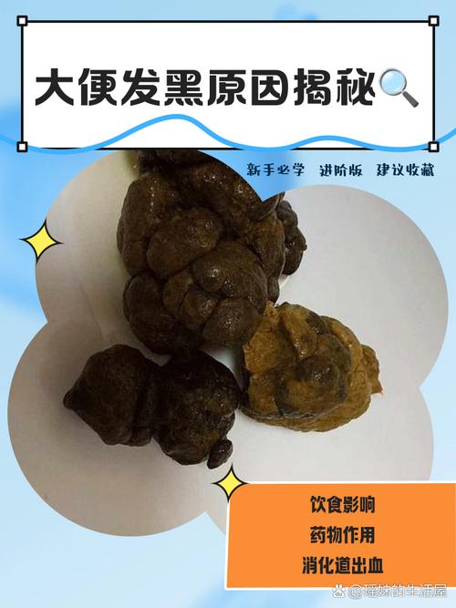 拉黑屎是什么原因图标