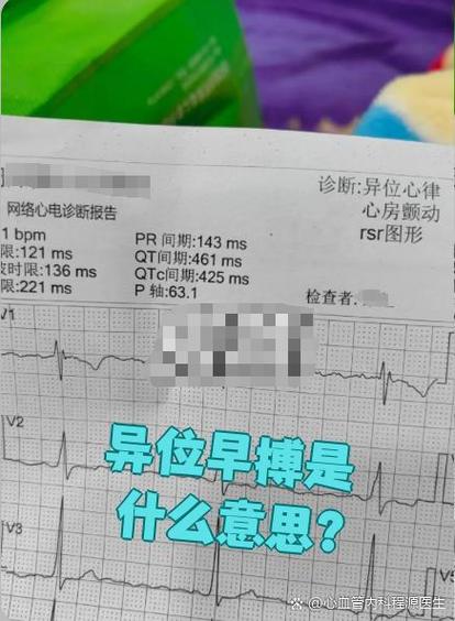 心脏起搏异常图标