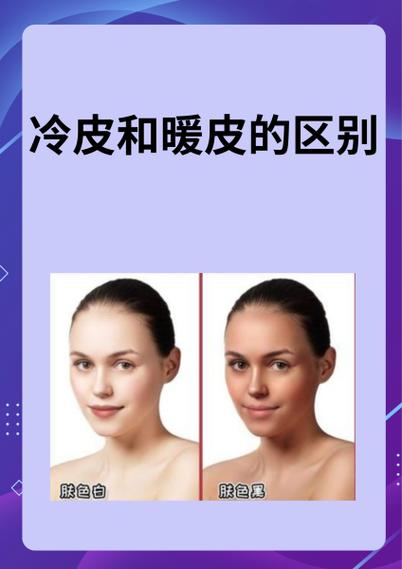 暖皮是白皮还是黄皮图标